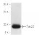 Anti-Tom20 Antibody (F-10) | SCBT - Santa Cruz Biotechnology