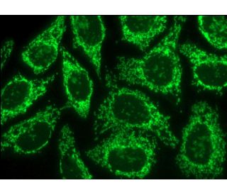 Tom20 (F-10) Alexa Fluor® 488: sc-17764 AF488. Direct ...