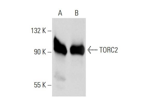 TORC2 Antibody (F-4) | SCBT - Santa Cruz Biotechnology