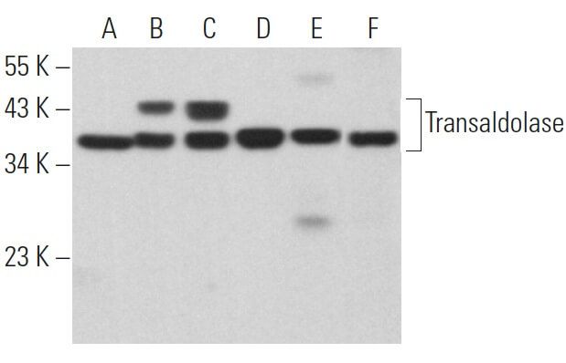 Transaldolase Antibody (C-5) | SCBT - Santa Cruz Biotechnology