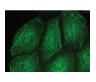 transgelin-2 Antibody (C-12) | SCBT - Santa Cruz Biotechnology