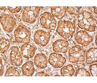 Anti-transgelin-2 Antibody (C-12) | SCBT - Santa Cruz Biotechnology