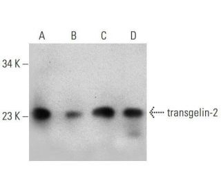 Anti-transgelin-2 Antibody (D-8) | SCBT - Santa Cruz Biotechnology