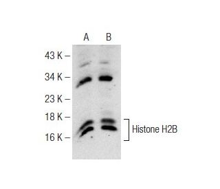 Trapoxin A, CAS 133155-89-2 | SCBT - Santa Cruz Biotechnology