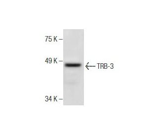 Anti-TRB-3 Antibody (B-2) | SCBT - Santa Cruz Biotechnology