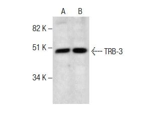 TRB-3 Antibody (B-2) | SCBT - Santa Cruz Biotechnology