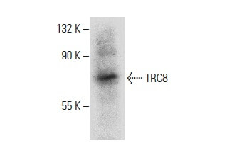 TRC8 Antibody (H-9) | SCBT - Santa Cruz Biotechnology