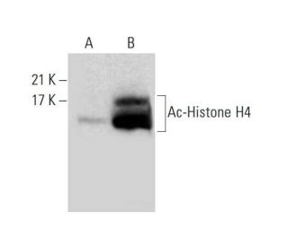 Trichostatin A | CAS 58880-19-6 | SCBT - Santa Cruz Biotechnology