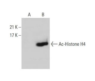 Trichostatin A | CAS 58880-19-6 | SCBT - Santa Cruz Biotechnology