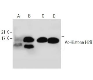 Trichostatin A | CAS 58880-19-6 | SCBT - Santa Cruz Biotechnology