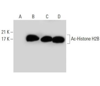 Trichostatin A | CAS 58880-19-6 | SCBT - Santa Cruz Biotechnology