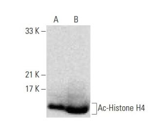 Trichostatin A | CAS 58880-19-6 | SCBT - Santa Cruz Biotechnology