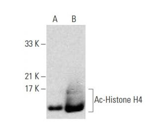 Trichostatin A | CAS 58880-19-6 | SCBT - Santa Cruz Biotechnology