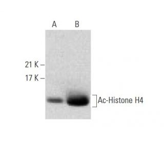 Trichostatin A | CAS 58880-19-6 | SCBT - Santa Cruz Biotechnology