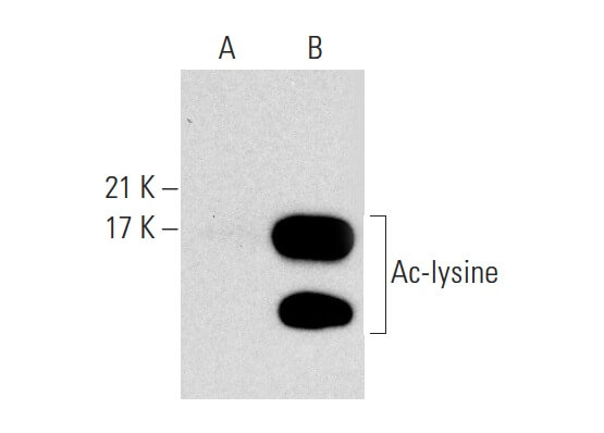 Trichostatin A | CAS 58880-19-6 | SCBT - Santa Cruz Biotechnology