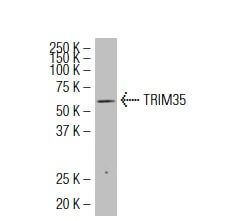 TRIM35抗体 (31-M) | SCBT - Santa Cruz Biotechnology