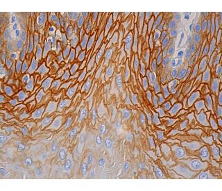 TROP-2 Antibody (B-9) - Immunohistochemistry - Image 391619