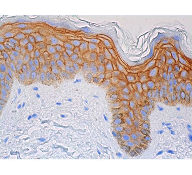 TROP-2 Antibody (B-9) | SCBT - Santa Cruz Biotechnology