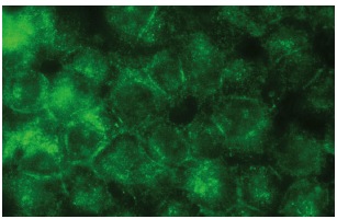 TRP1 Antibody (G-9) | SCBT - Santa Cruz Biotechnology