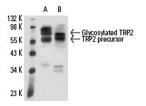 Anti-TRP2/DCT Antibody (C-9) | SCBT - Santa Cruz Biotechnology