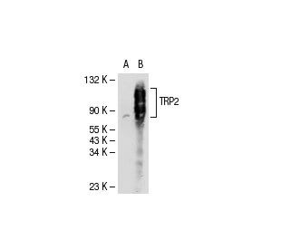 TRP2/DCT Antibody (C-9) | SCBT - Santa Cruz Biotechnology