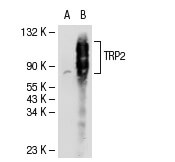 TRP2/DCT Antibody (C-9) | SCBT - Santa Cruz Biotechnology