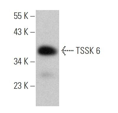 TSSK 6 Antibody (F-6) | SCBT - Santa Cruz Biotechnology