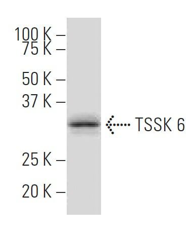 TSSK 6 Antibody (M-12) | SCBT - Santa Cruz Biotechnology