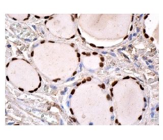TTF-1 Antibody (8G7G3/1) - Immunohistochemistry - Image 156766