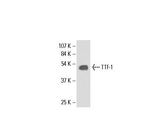 TTF-1 Antibody (8G7G3/1) - Western Blotting - Image 17588