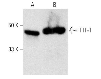 Anti-TTF-1/Thyroid Transcription Factor 1/NKX2-1 Antibody (F-12) | SCBT ...