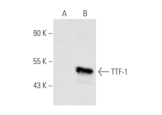Anti-TTF-1/Thyroid Transcription Factor 1/NKX2-1 Antibody (F-12) | SCBT ...