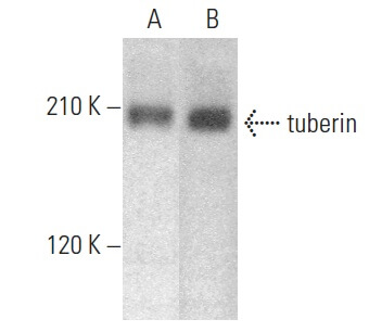 Anti-tuberin Antibody (B-5) | SCBT - Santa Cruz Biotechnology
