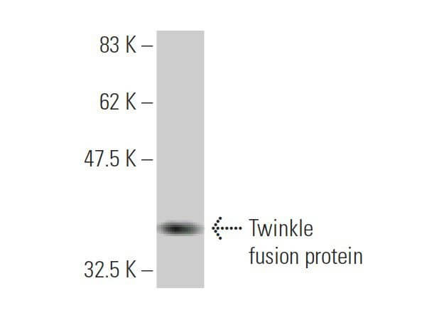 Anti-Twinkle Antibody (1C5) | SCBT - Santa Cruz Biotechnology
