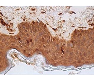UBC9 Antibody (C-12) - Immunohistochemistry - Image 370193