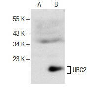 UBE2A/B Antibody (G-9) | SCBT - Santa Cruz Biotechnology
