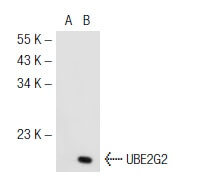 Anti-UBE2G2 Antibody (2E6) | SCBT - Santa Cruz Biotechnology