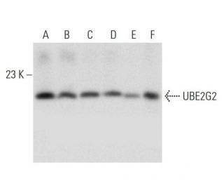 UBE2G2 Antibody (D-4) | SCBT - Santa Cruz Biotechnology