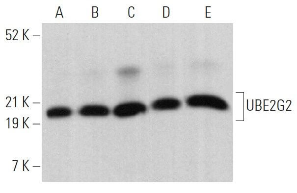 UBE2G2 Antibody (D-4) | SCBT - Santa Cruz Biotechnology