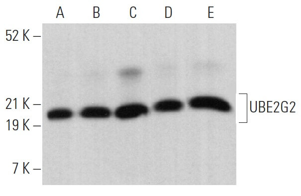 UBE2G2 Antibody (D-4) | SCBT - Santa Cruz Biotechnology