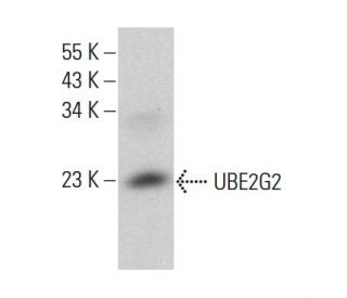 UBE2G2 Antibody (D-4) | SCBT - Santa Cruz Biotechnology