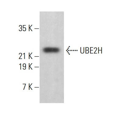 Anti-UBE2H Antibody (G-2) | SCBT - Santa Cruz Biotechnology