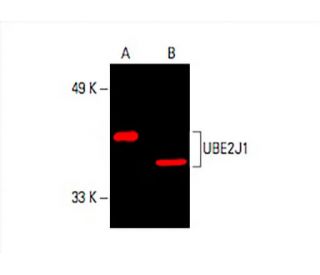 Anti-UBE2J1 Antibody (B-6) | SCBT - Santa Cruz Biotechnology
