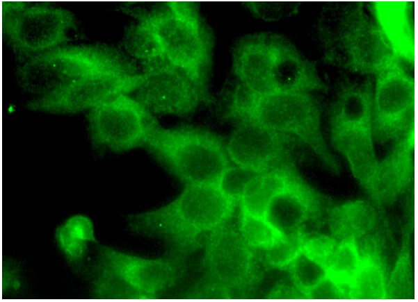 Anti-UBE4A Antibody (B-6) | SCBT - Santa Cruz Biotechnology