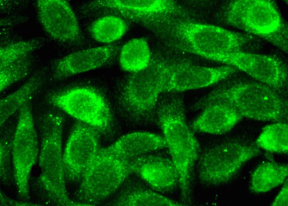 Anti-UBE4A Antibody (B-6) | SCBT - Santa Cruz Biotechnology