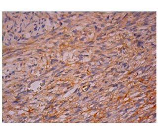 Anti-UBE4A Antibody (B-6) | SCBT - Santa Cruz Biotechnology