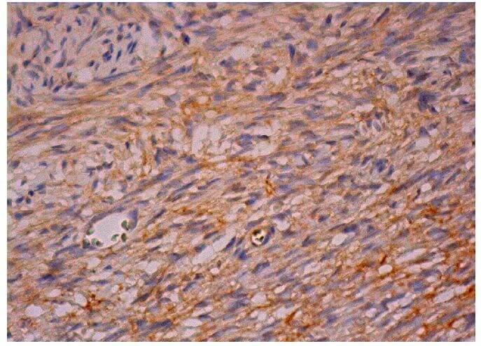 Anti-UBE4A Antibody (B-6) | SCBT - Santa Cruz Biotechnology
