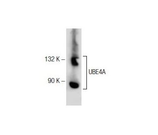 Anti-UBE4A Antibody (B-6) | SCBT - Santa Cruz Biotechnology