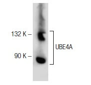 Anti-UBE4A Antibody (B-6) | SCBT - Santa Cruz Biotechnology