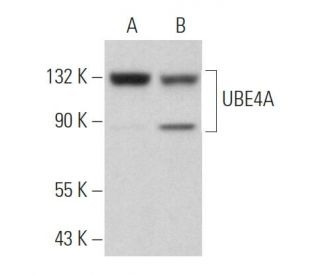 Anti-UBE4A Antibody (B-6) | SCBT - Santa Cruz Biotechnology